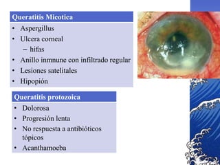 Afecciones oculares | PPTX