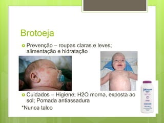 Doenças frequentes da infancia - pediatria | PPTX
