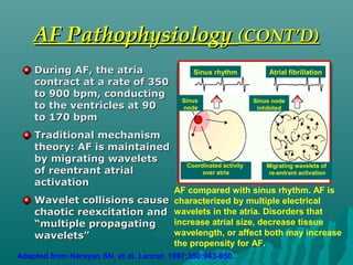 Af epidemiology and diagnosis | PPT | Heart and Cardiovascular Diseases ...