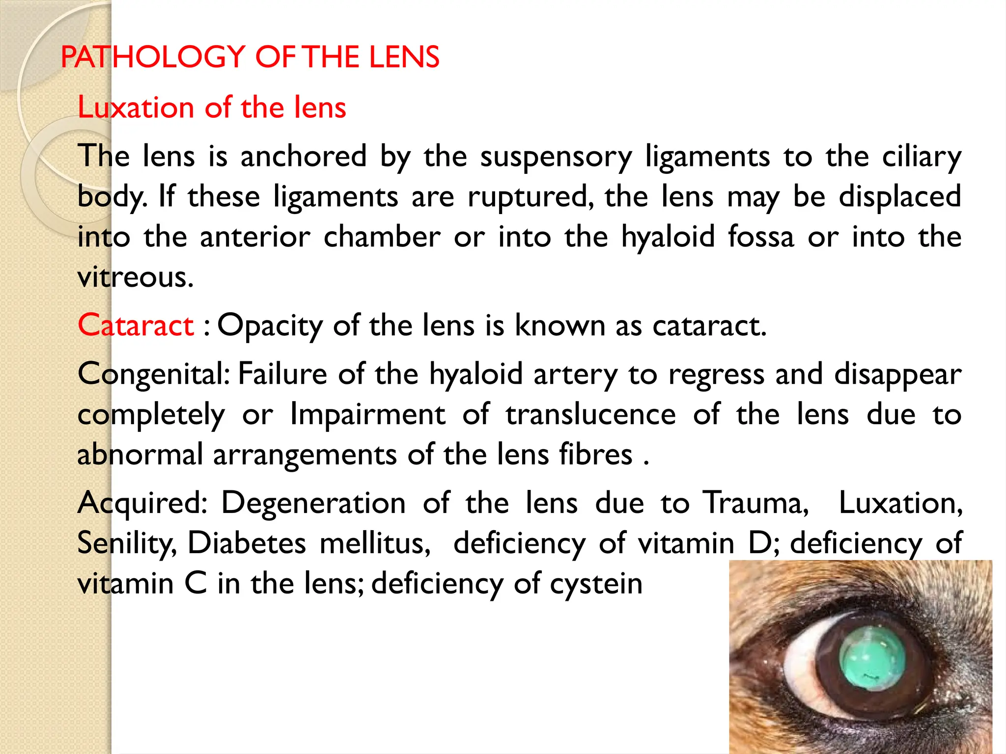 AFFECTIONS_OF_EYE___EAR_BY_DR._SANJIV_KUMAR_- (1).pptx