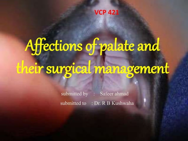 Affections of palate and their surgical management | PPTX