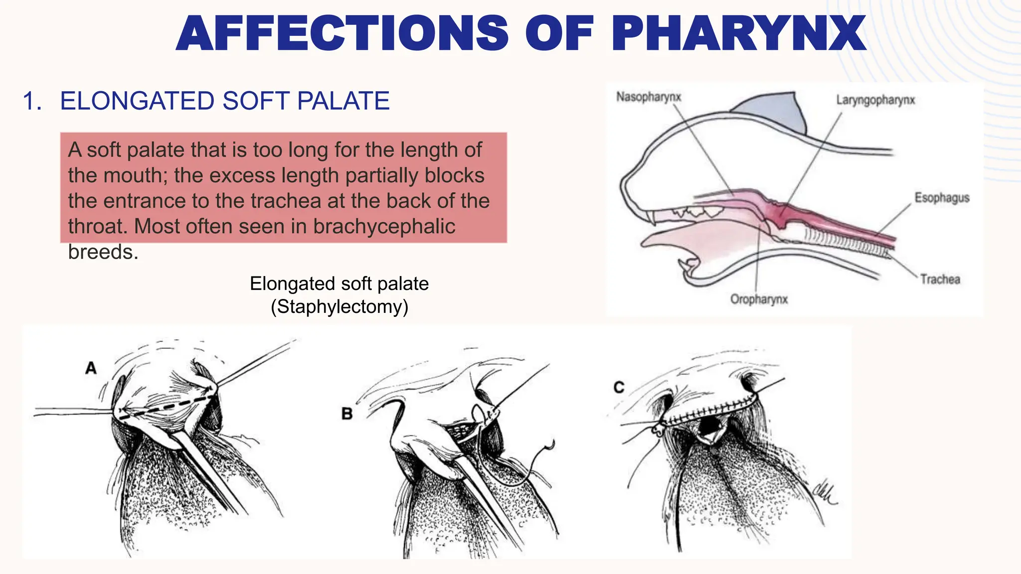 AFFECTIONS OF PHARYNX AND LARYNX.pptx