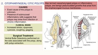 AFFECTIONS OF PHARYNX AND LARYNX.pptx