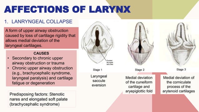 AFFECTIONS OF PHARYNX AND LARYNX.pptx