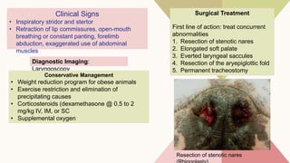AFFECTIONS OF PHARYNX AND LARYNX.pptx