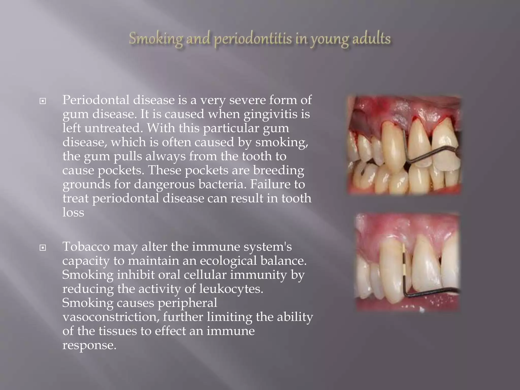 Affect of smoking on periodontium | PPTX