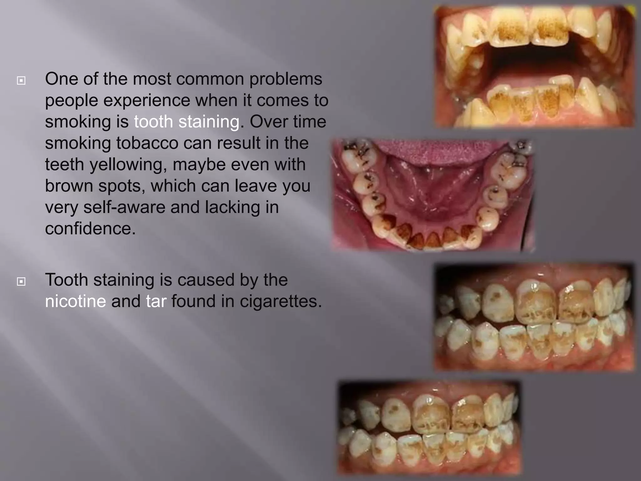 Affect of smoking on periodontium | PPTX
