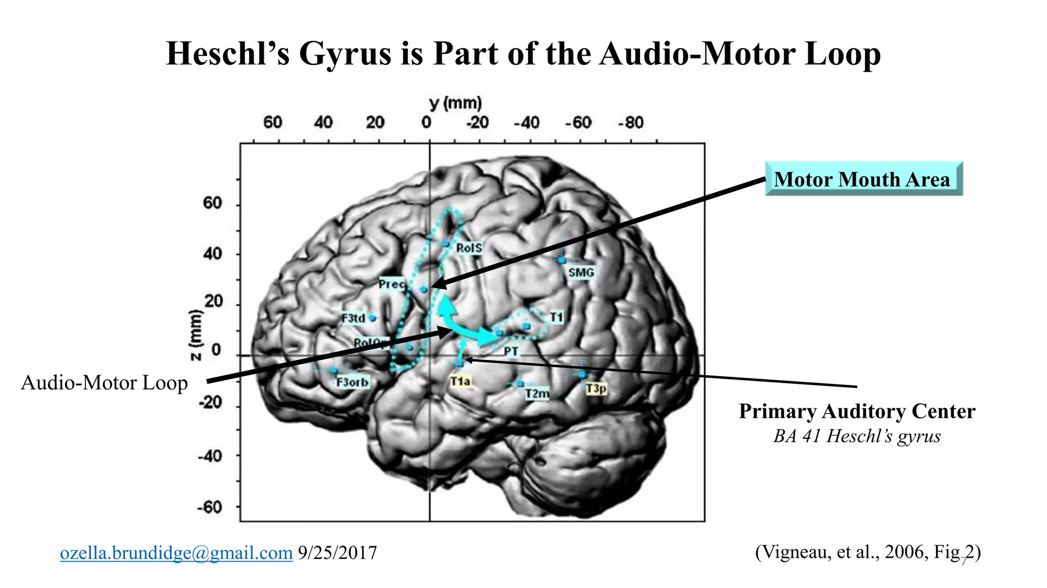 Affects of preterm birth on auditory processing | PPTX