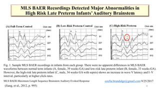 Affects of preterm birth on auditory processing | PPTX