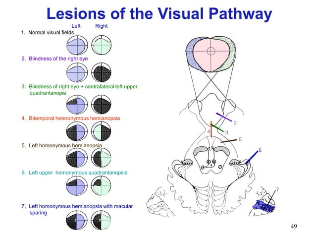 Afferent visual pathway | PDF