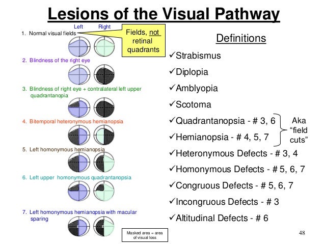 Afferent visual pathway