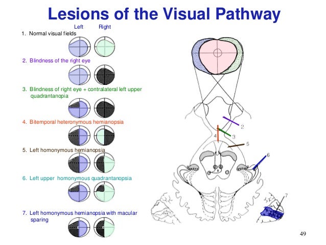 Afferent visual pathway