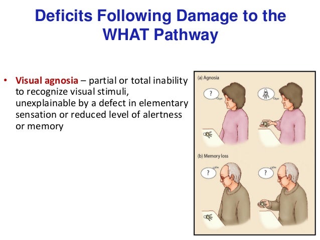 Afferent visual pathway