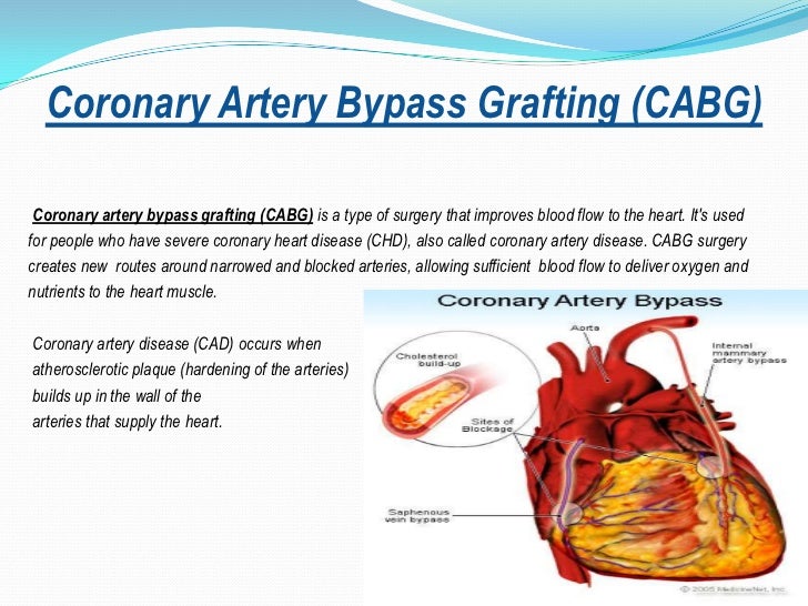 Affordable cabg treatment