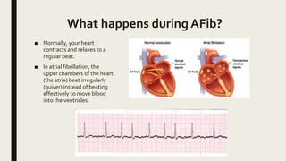 Understanding Atrial Fibrillation | PPT