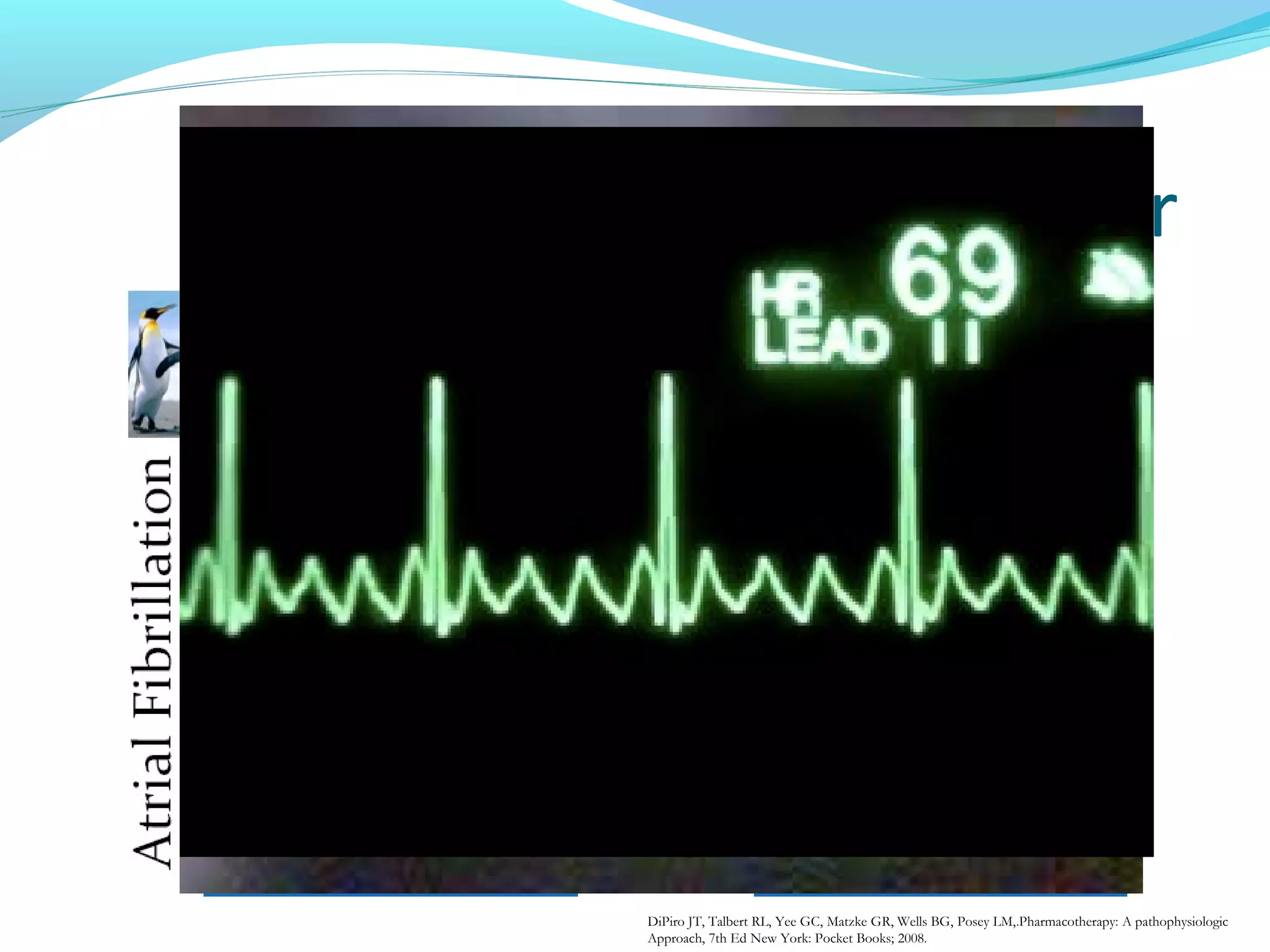 Atrial Fibrillation/Flutter Presentation | PPT