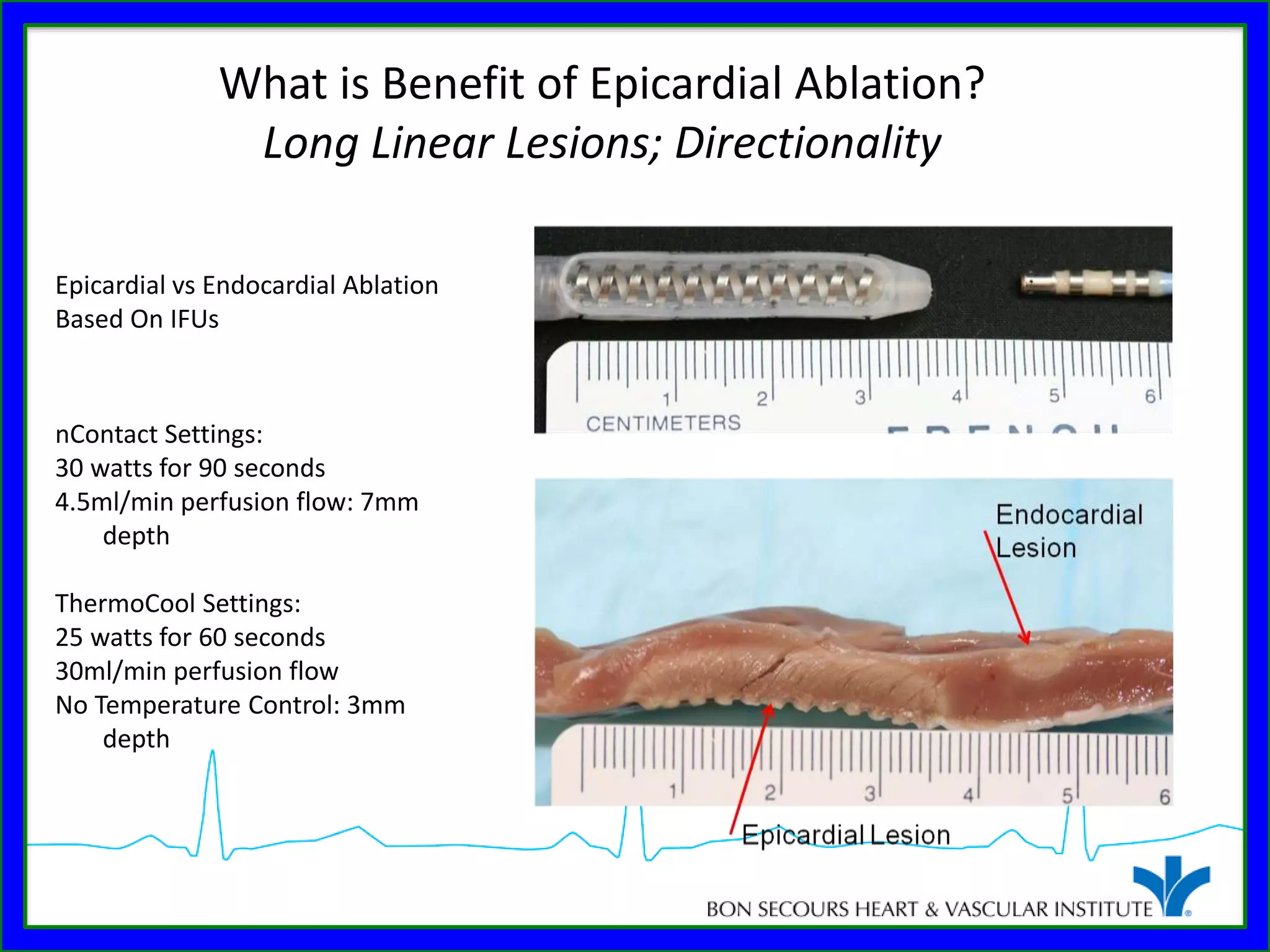 A fib treatment strategies | PPTX