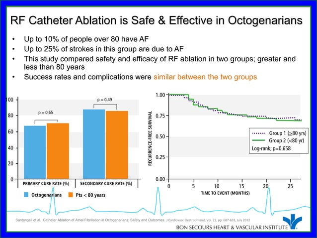 A fib treatment strategies | PPTX
