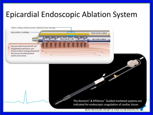 A fib treatment strategies | PPTX