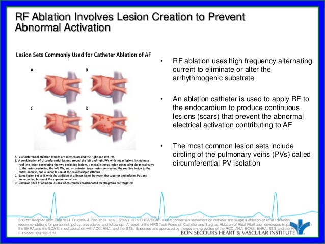 A fib treatment strategies