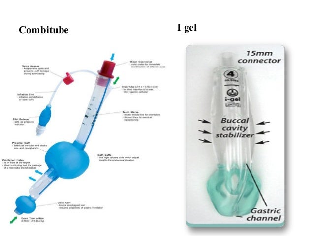 MANAGEMENT OF DIFFICULT AIRWAY