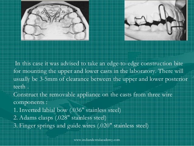 A fixed reverse labial bow for moderate class 3