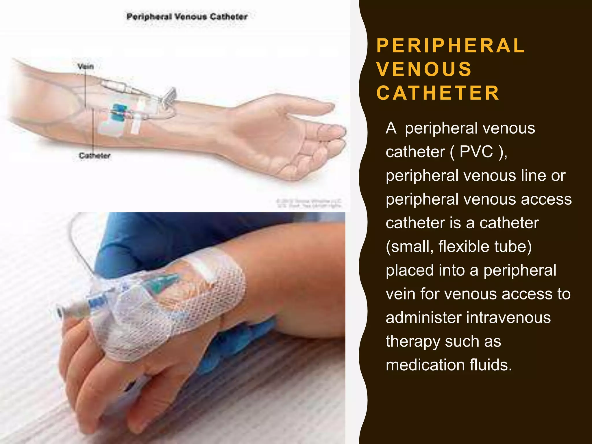 Fluid resuscitation in burn patient | PPTX