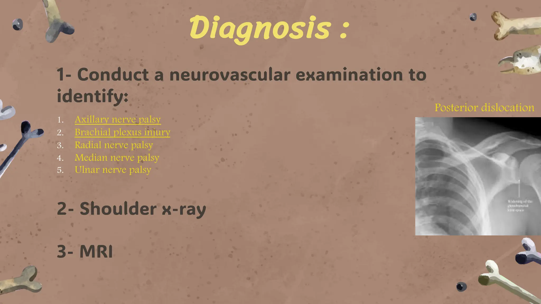Afnan Shoulder dislocation.pdforthopedics | PDF