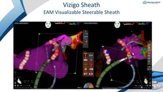 New Technologies for Atrial Fibrillation Ablation | PPTX