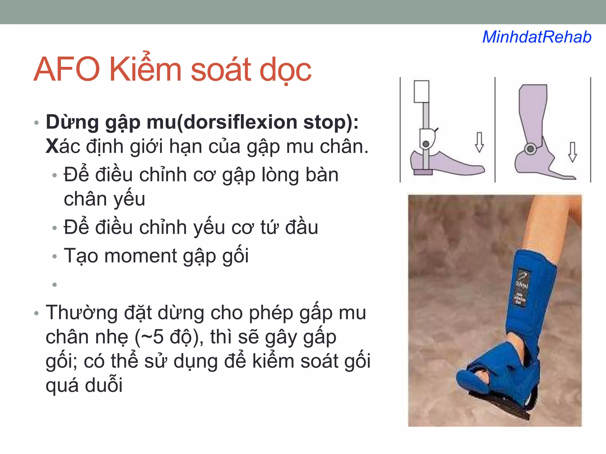 Nẹp cổ bàn chân AFO | PPTX