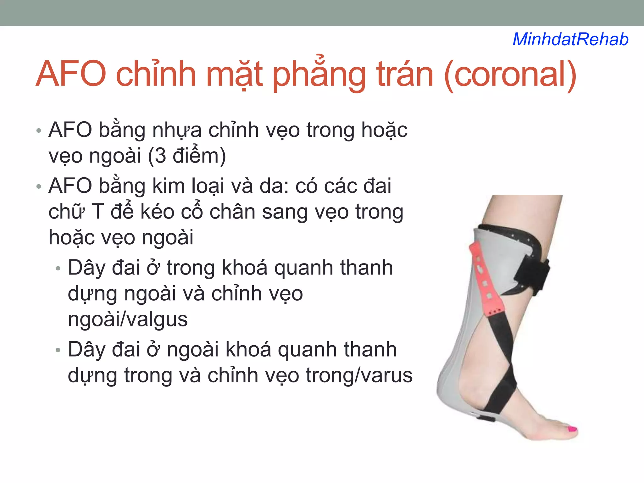 Nẹp cổ bàn chân AFO | PPTX