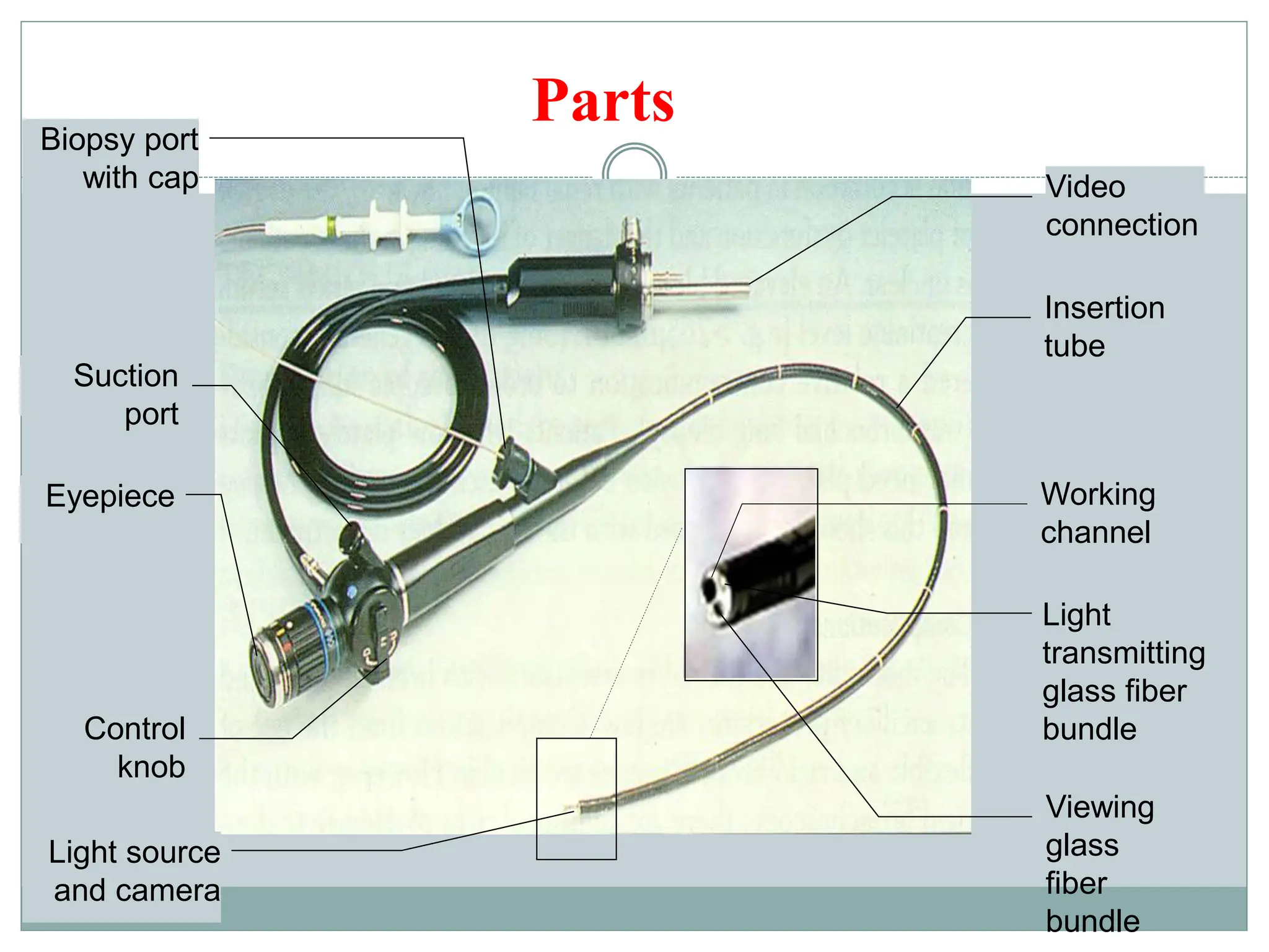 Awake fibrioptic Intubation in difficult airway | PPTX