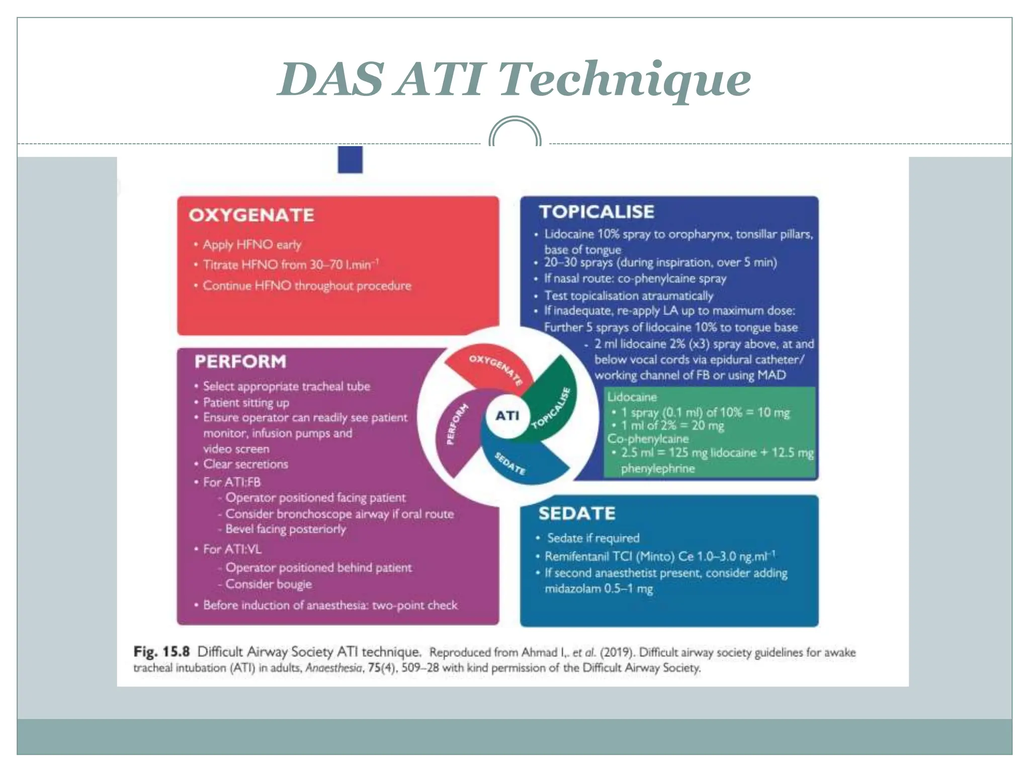 Awake fibrioptic Intubation in difficult airway | PPTX