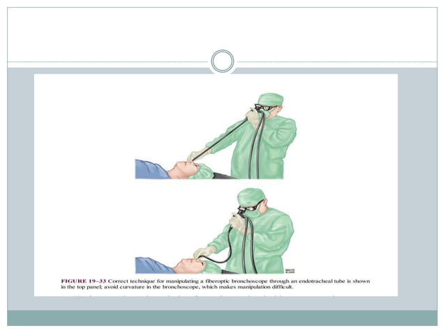 Awake fibrioptic Intubation in difficult airway | PPTX | First Aid ...