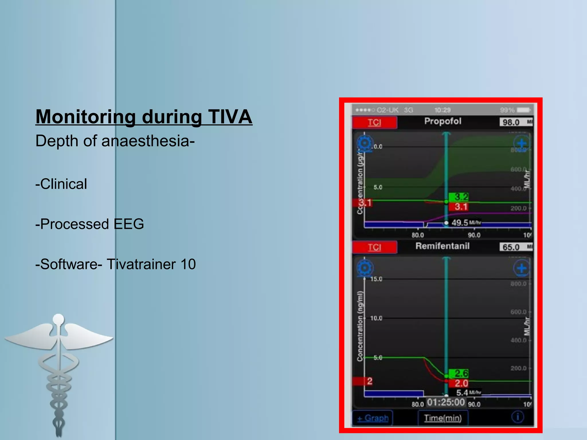 AWAKE FIBEROPTIC INTUBATION & TIVA- simplified | PPT