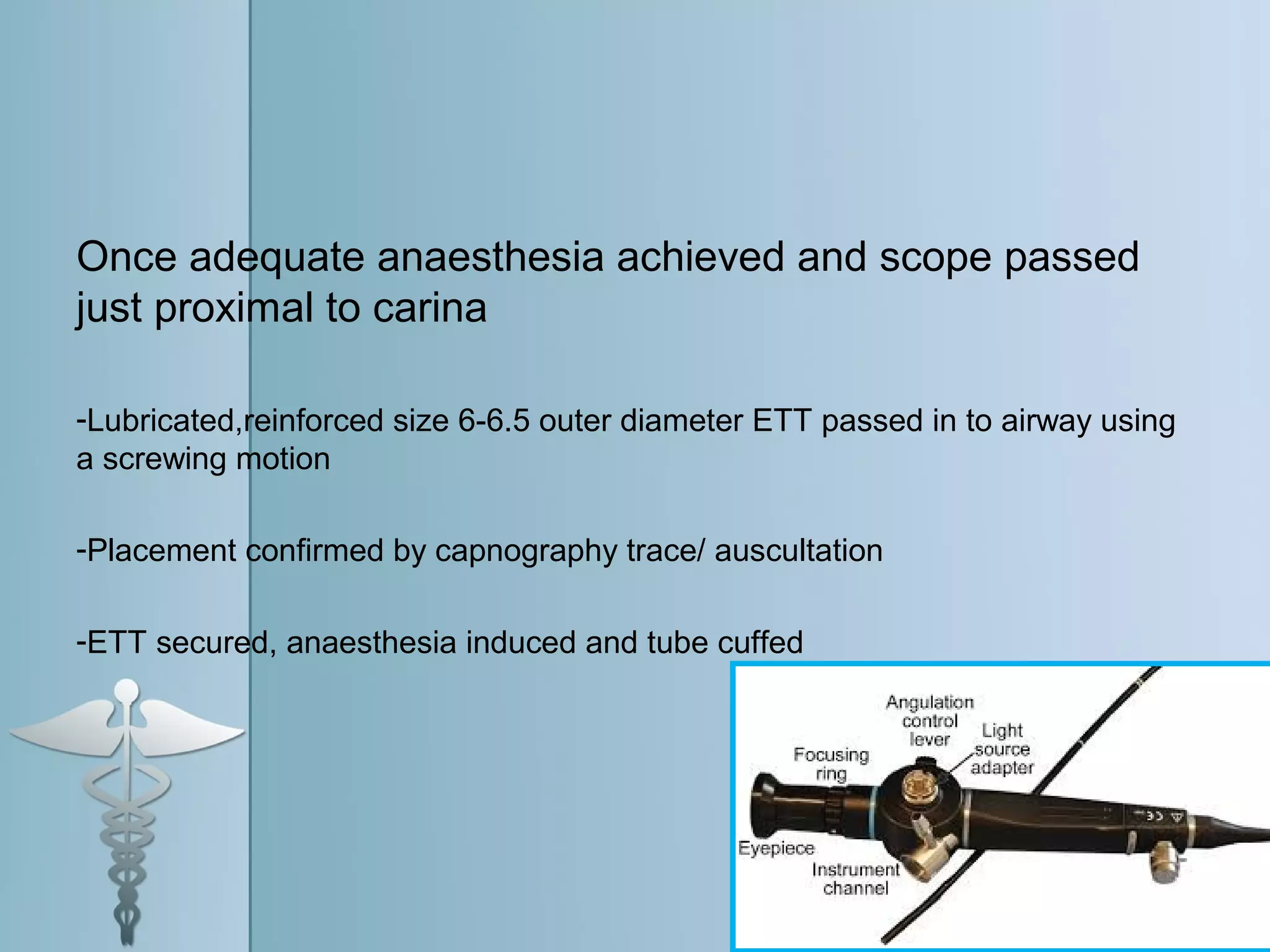 AWAKE FIBEROPTIC INTUBATION & TIVA- simplified | PPT