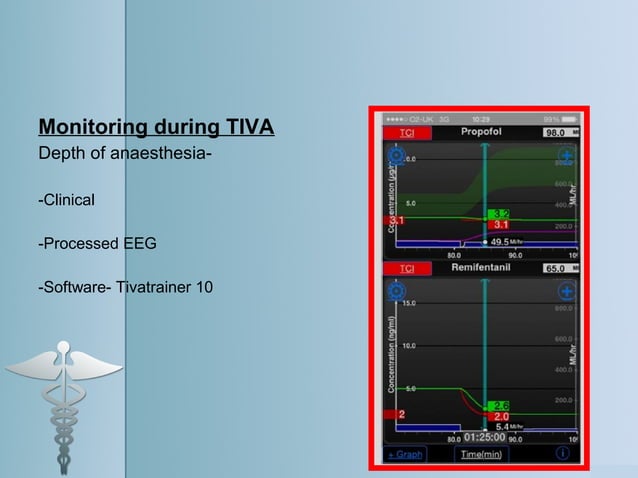 AWAKE FIBEROPTIC INTUBATION & TIVA- simplified | PPT