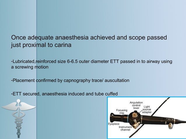 AWAKE FIBEROPTIC INTUBATION & TIVA- simplified | PPT