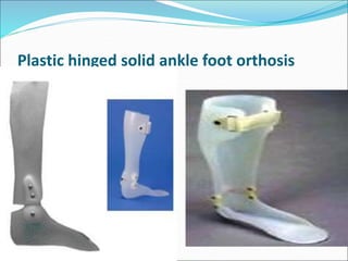 AFO PPT(Ankle foot orthosis, physiotherapy.ppt