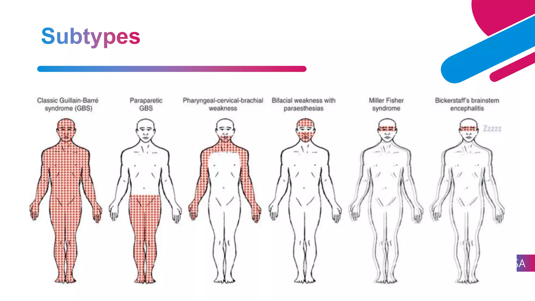 Acute flaccid paralysis , Polio , Transverse myelitis, AFP survillence ...