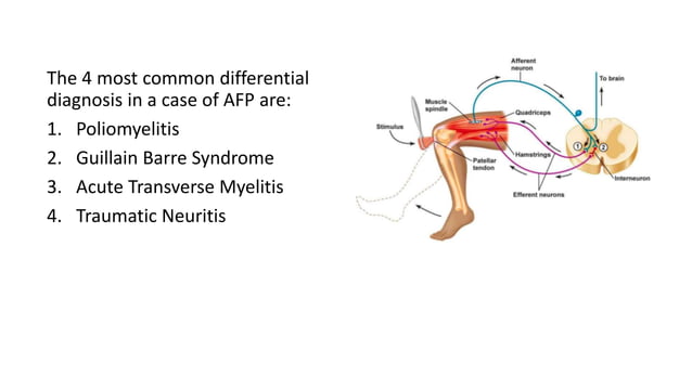 Acute Flaccid Paralysis | PPTX