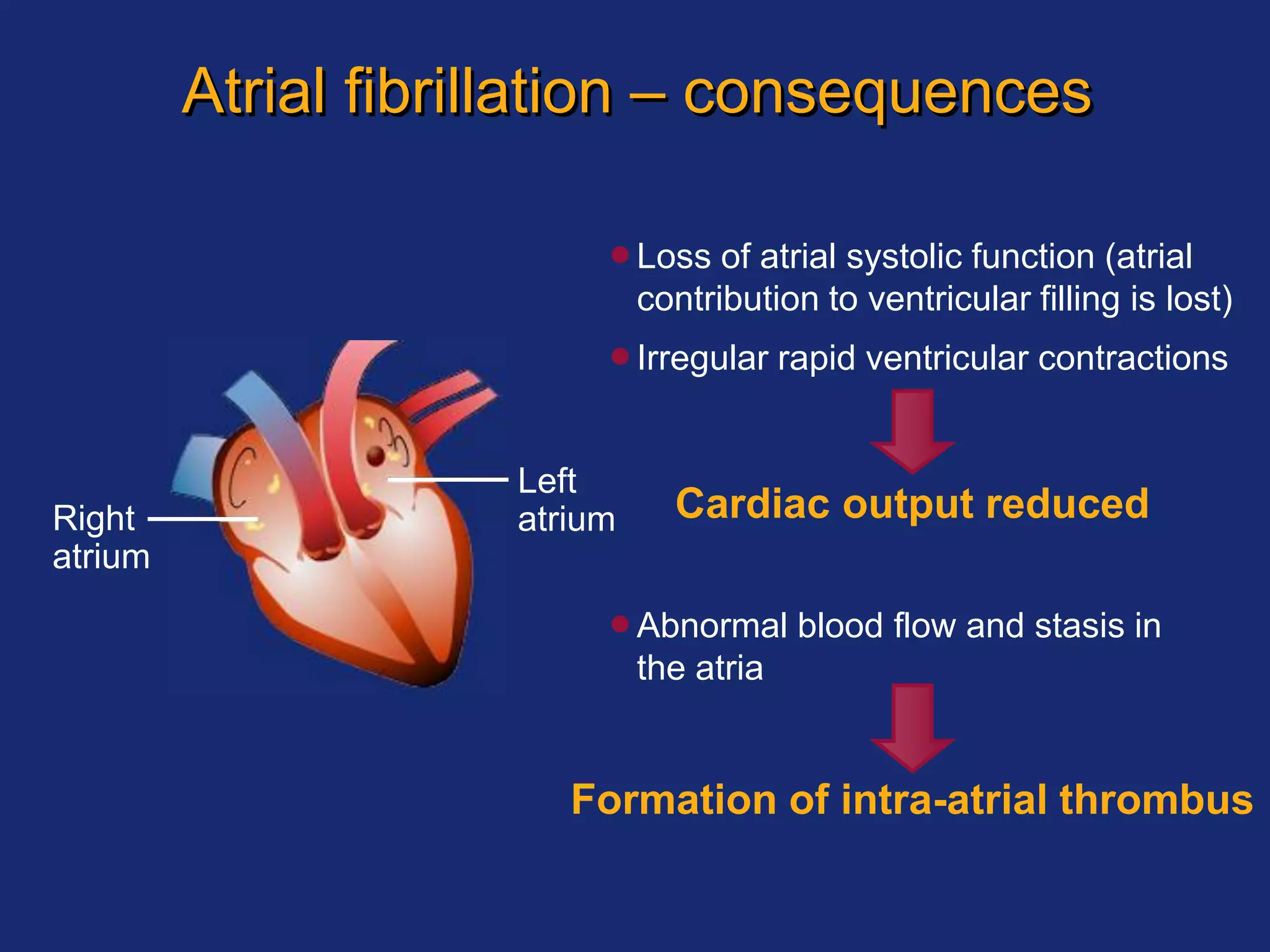 Atrial Fibrillation Epidemiology, pathogenesis, diagnosis and treatment ...