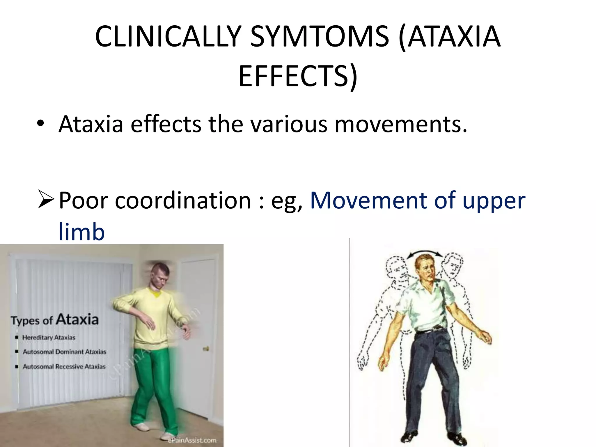 cerebellar dysfunction-ppt | PPTX