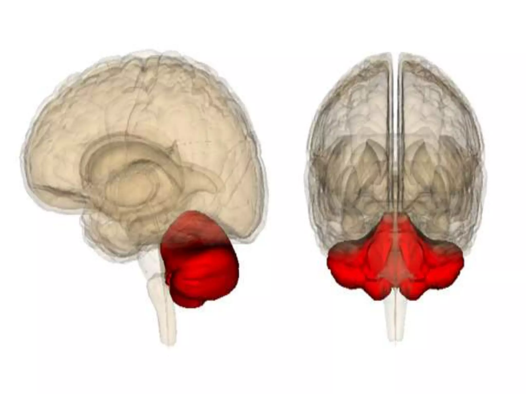 cerebellar dysfunction-ppt | PPTX