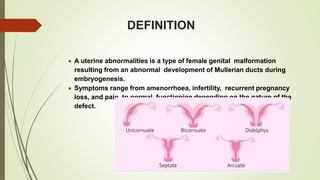 Uterine abnormalities | PDF