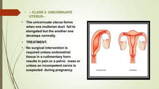 Uterine abnormalities | PDF