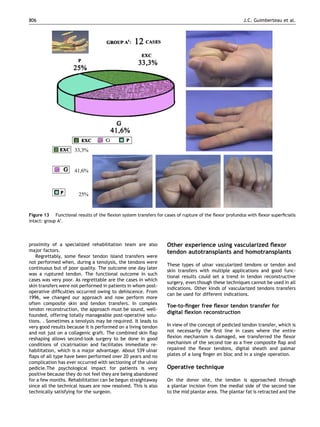 A fresh look at vascularized flexor tendon transfers | PDF