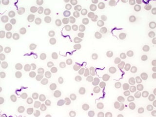 Trypanosoma Microscope Slide