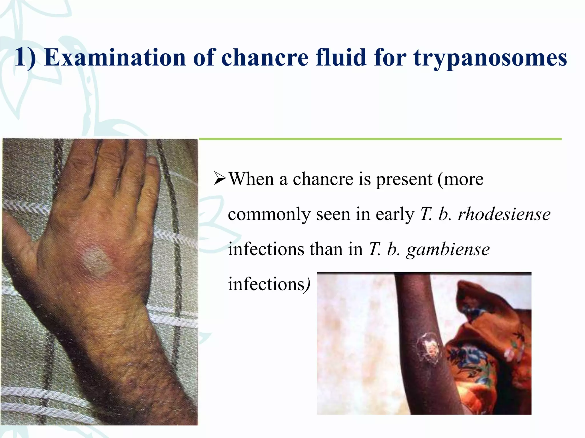 African trypanosomes | PPSX