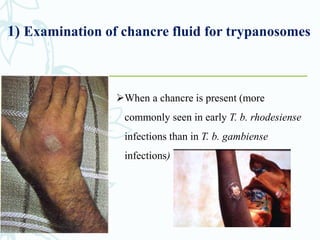 African trypanosomes | PPSX